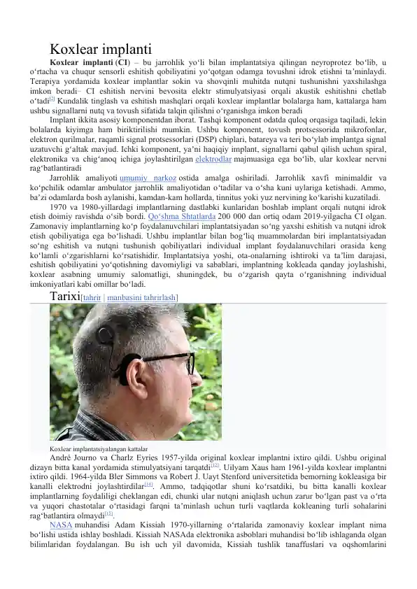 Koxlear implanti