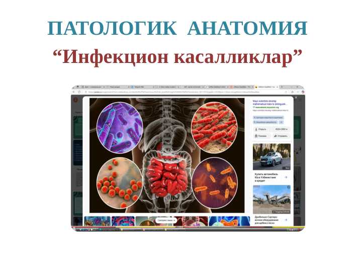 Infeksion kasalliklar haqida ma'lumot