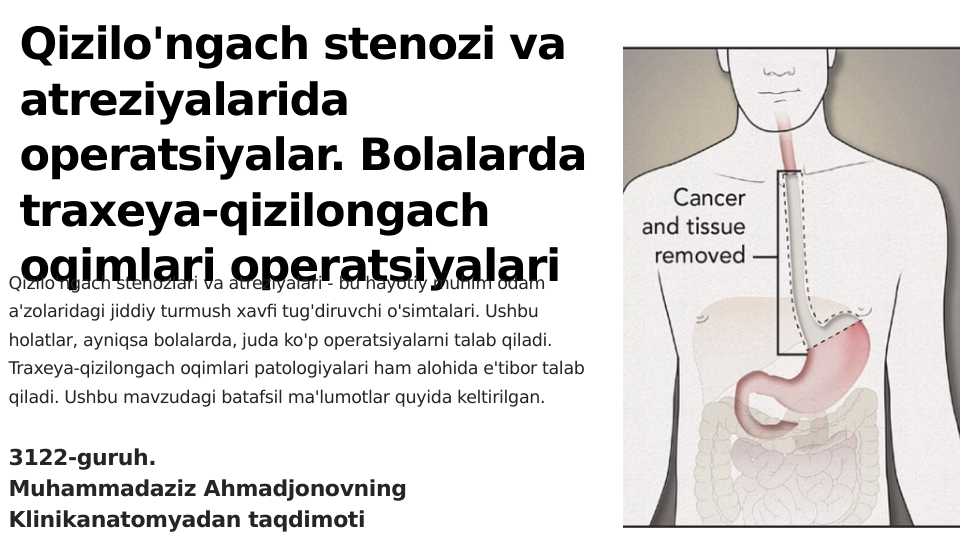 Qizilo'ngach stenozi va atreziyalarida operatsiyalar. Bolalarda traxeya ...