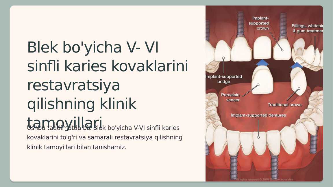 Blek bo‘yicha V- VI sinfli karies kovaklarini restavratsiya qilishning ...