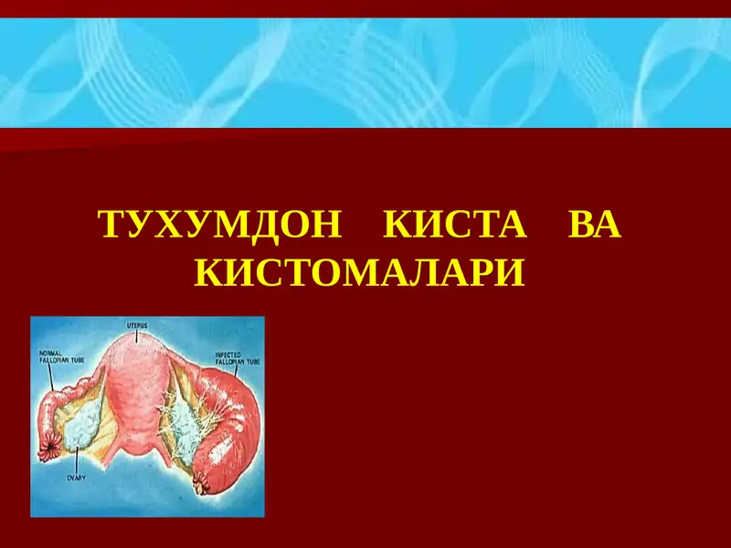 TUXUMDON KISTA VA KISTOMALARI